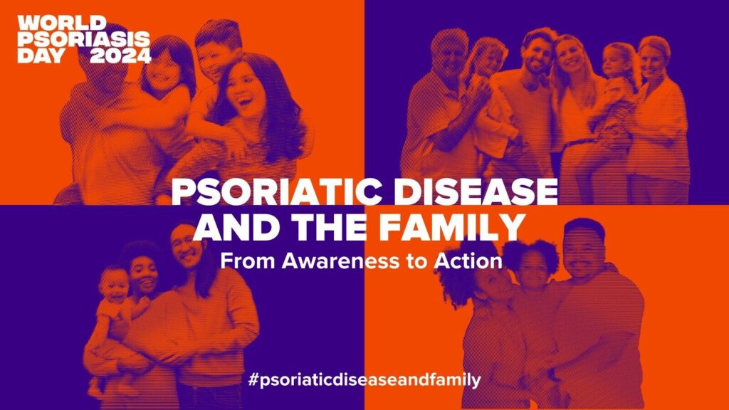 World Psoriasis Day 2024: Psoriatic Disease and Family--Standing ...