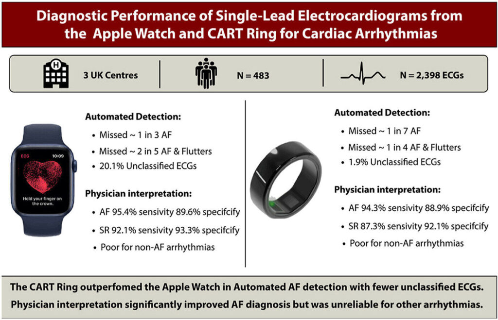 UK Clinical Study Finds Sky Labs' Smart Ring 'CART-I' More Sensitive ...