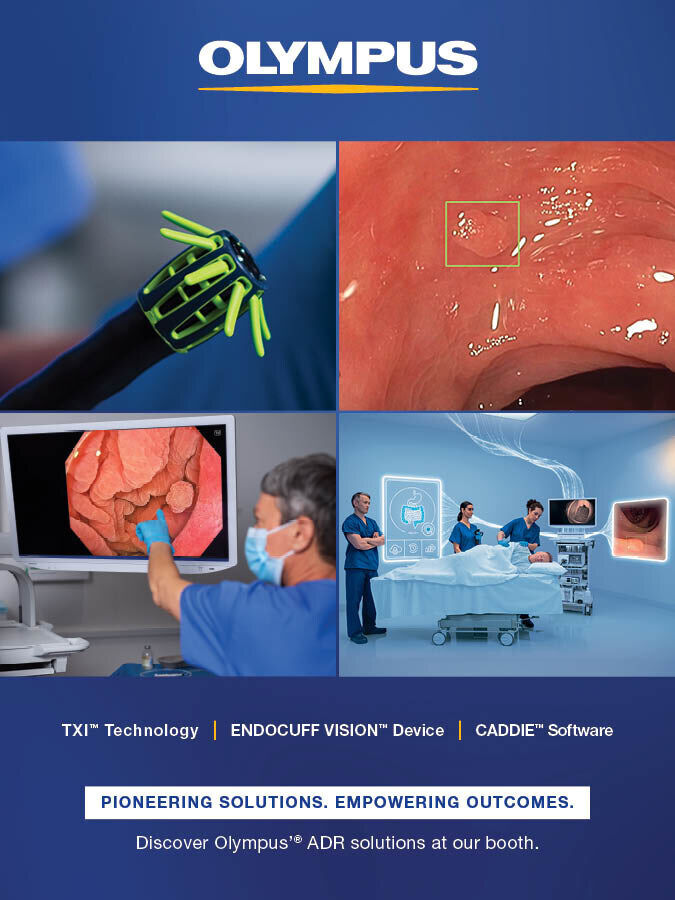 Olympus Demonstrates New AI Endoscopy Solution at DDW® - Salamanca Free ...